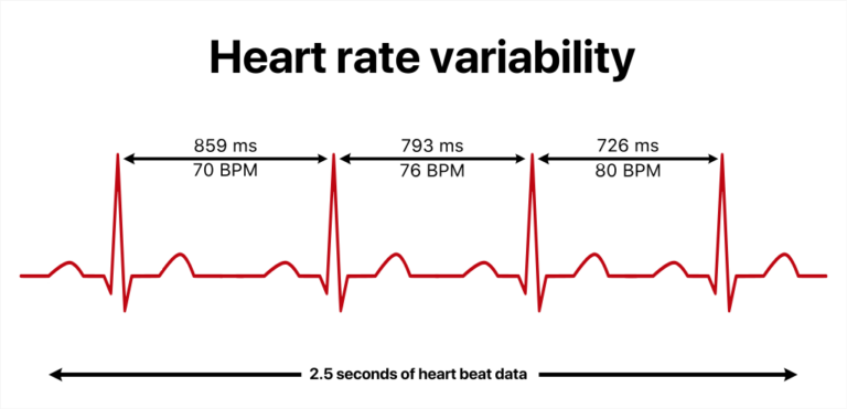 Does Heart Rate Variability Detect Overtraining? - Wu Tsai Human ...